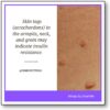 Signs of Insulin Resistance – Do You Have Them? - Dr Becky Fitness